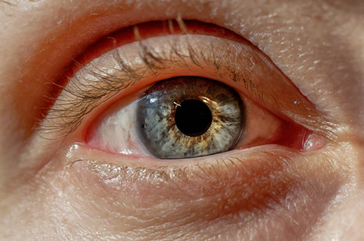 Eye Health Center - Tampa Eye Clinic