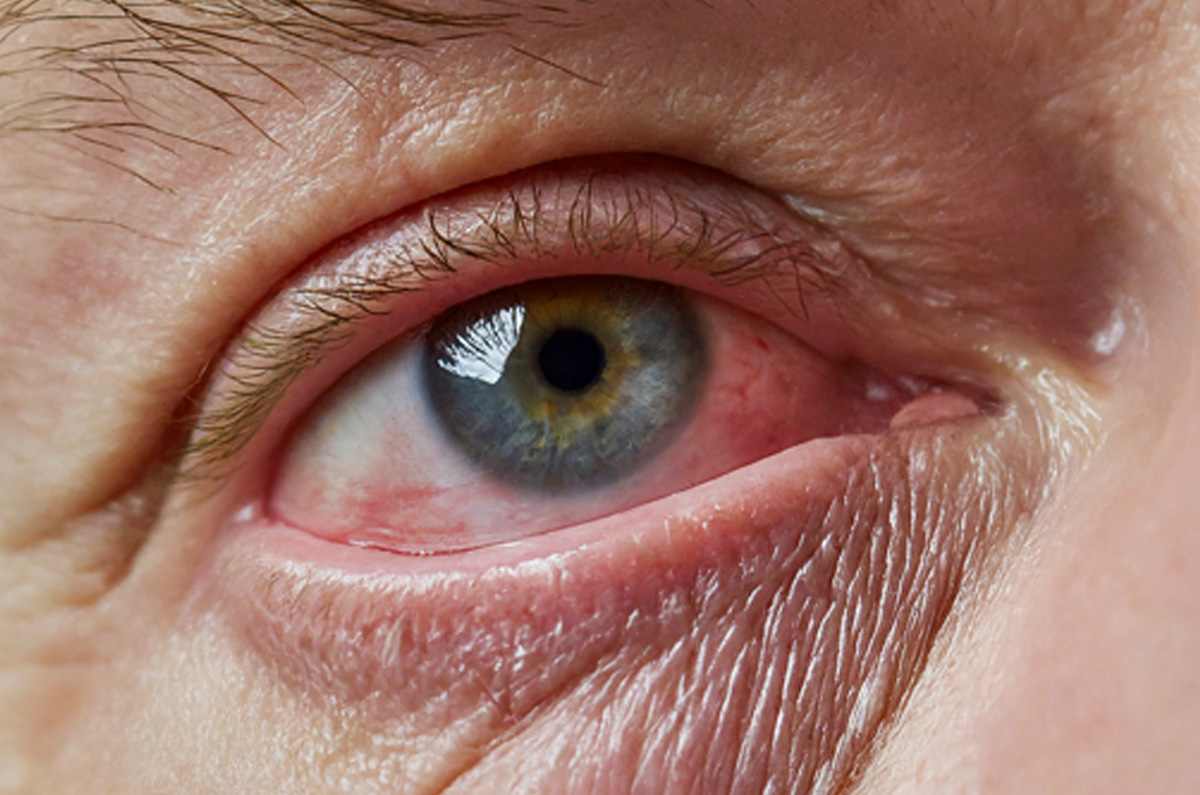 Eye Health Center - Tampa Eye Clinic